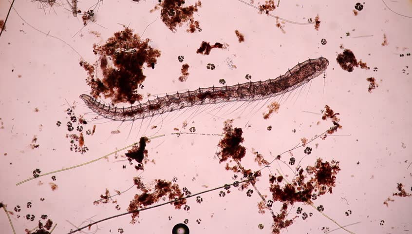 Annelida Stock Video Footage - 4K and HD Video Clips | Shutterstock
