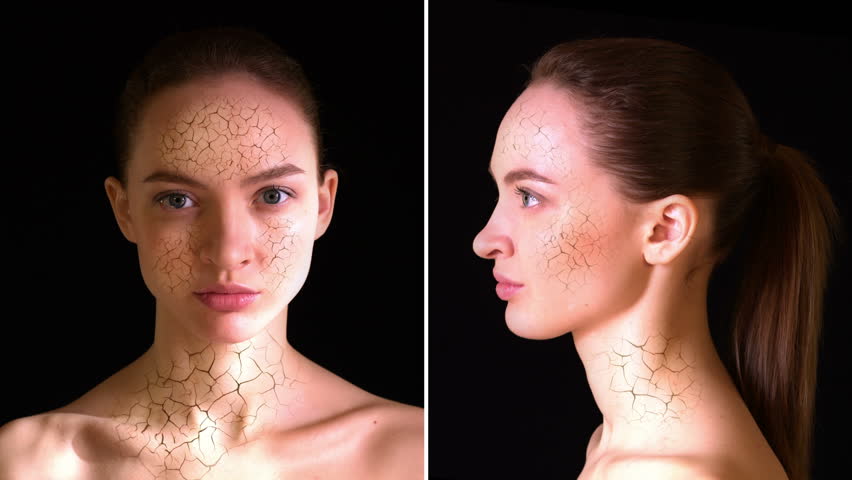 Stock video of dry skin. girl with dry skin | 15044260 | Shutterstock