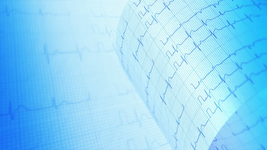 Heart Rate, Electrocardiogram, ECG Medical Background. LOOP. Full HD ...