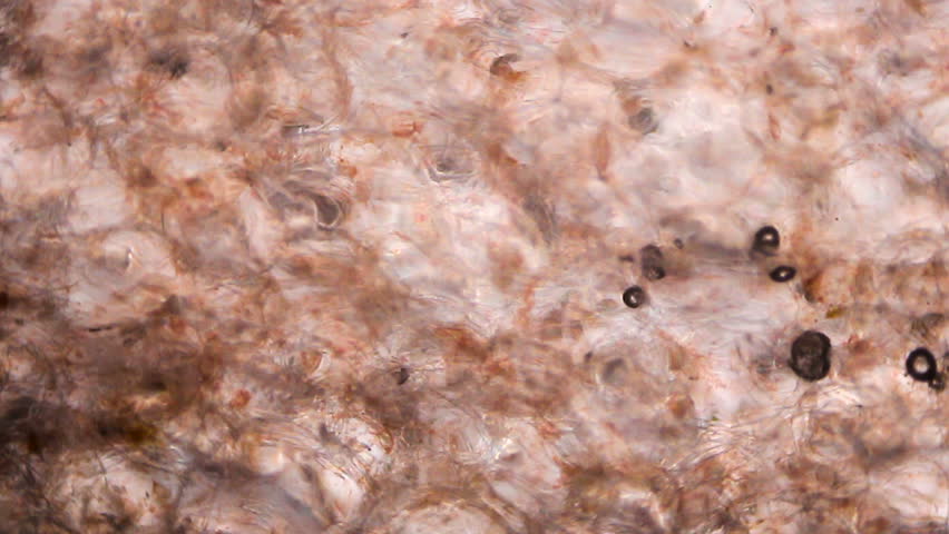 Focusing To Tomato Cells Examination Under Microscope. Microscopic ...