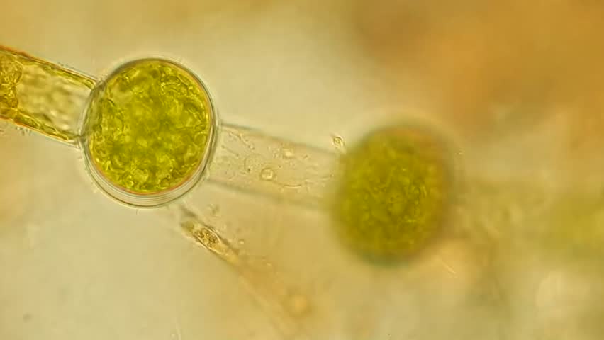 Seaweed (algae Anabena) Under Microscope, Stock Footage Video (100% ...