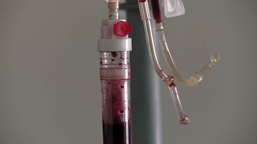 Infusion Sets, Blood Transfusion Stock Footage Video (100% Royalty-free ...