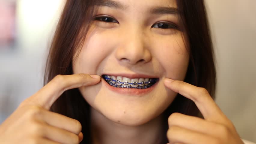 Stock video of attractive young woman pointing her brackets | 19883740 ...