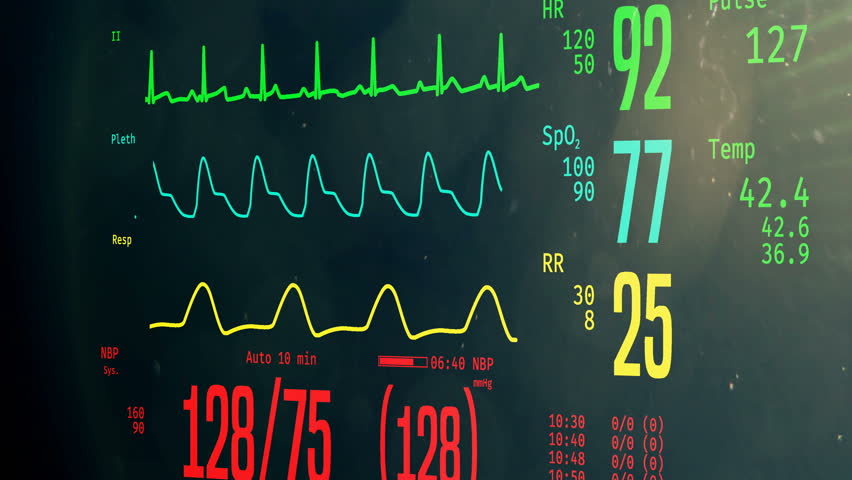 Close Up Of Patient Monitor Displays Vital Signs - EKG, Oxygen ...
