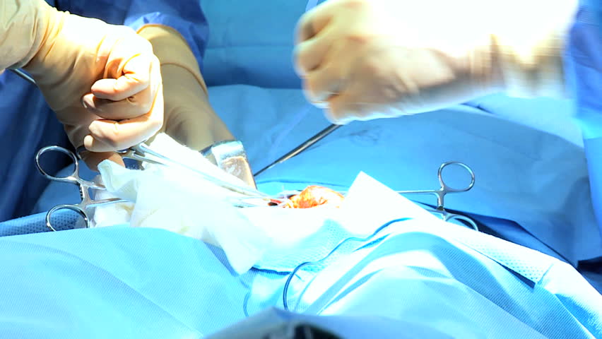 Senior Doctor Performing Operation Using Stock Footage Video (100% ...