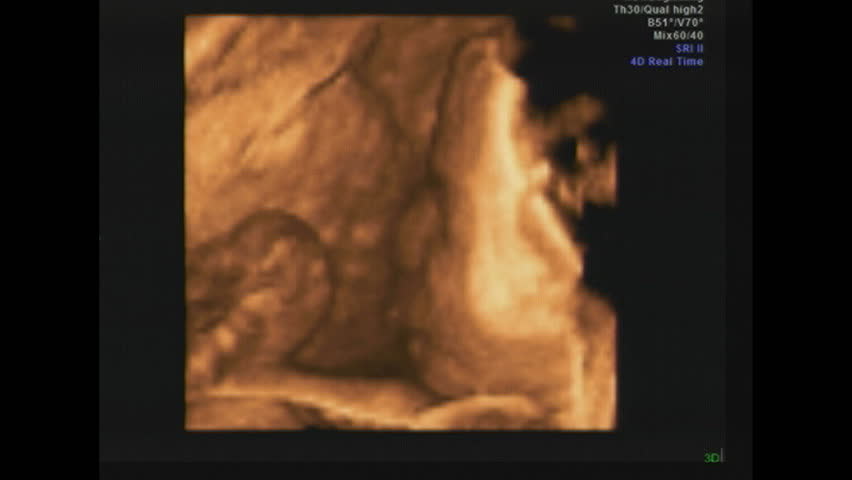 A 4D Ultrasound Of A Beautiful Baby At 30 Weeks Gestation Stock Footage ...