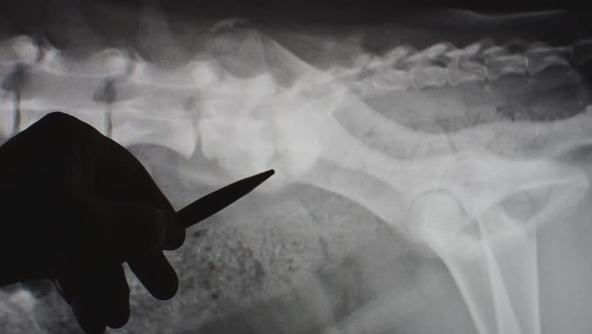 Veterinarian Explaining Radiograph To A Pet Owner. This Is A Fairly ...