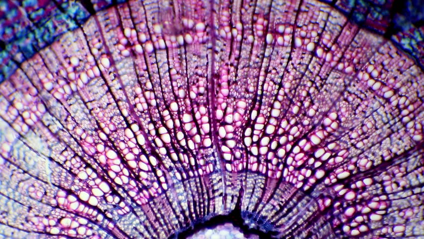 Longitudinal Section Of The Stem Woody Plant Under The Microscope ...